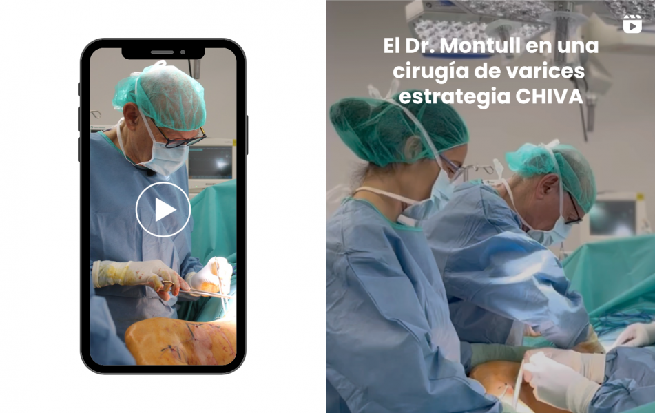 solución inovadora para las varices
